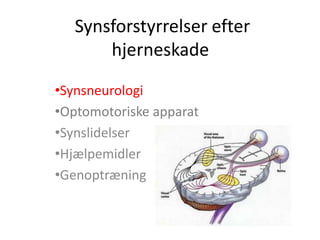 Hjerneskade; syn og øjne | PPTX