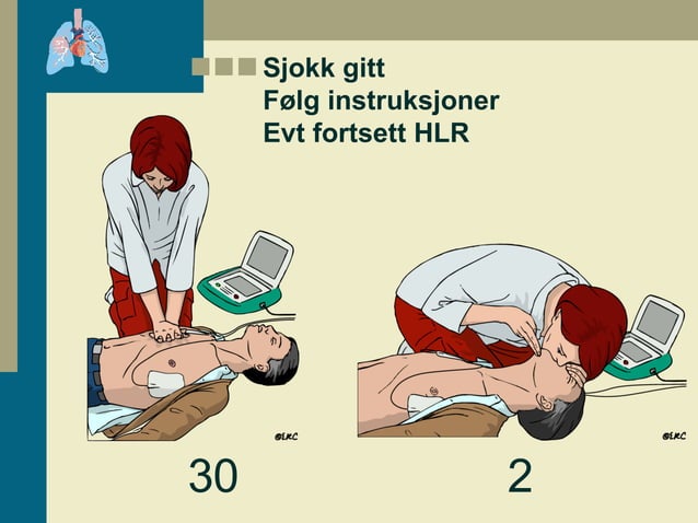 Hjertestans AHLR | PPT