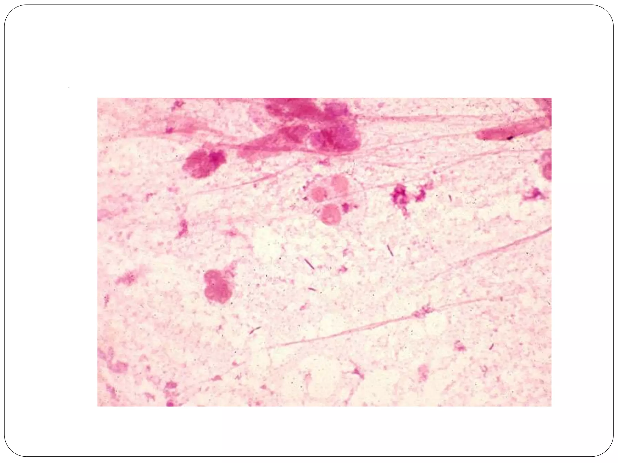 Direct microscopy | PPTX