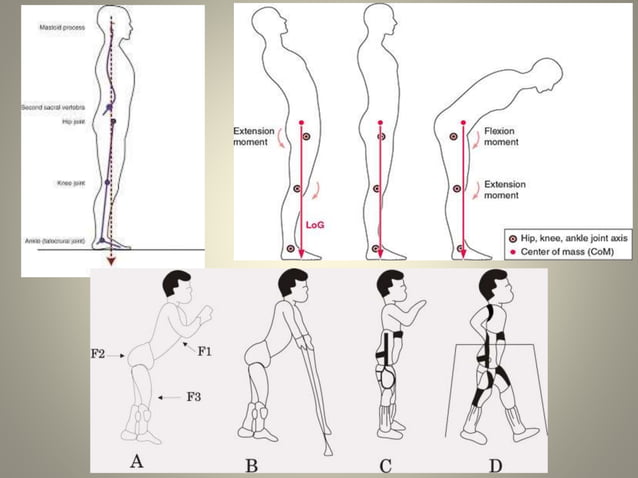 HKAFOs and KAFOs ambulation | PPTX