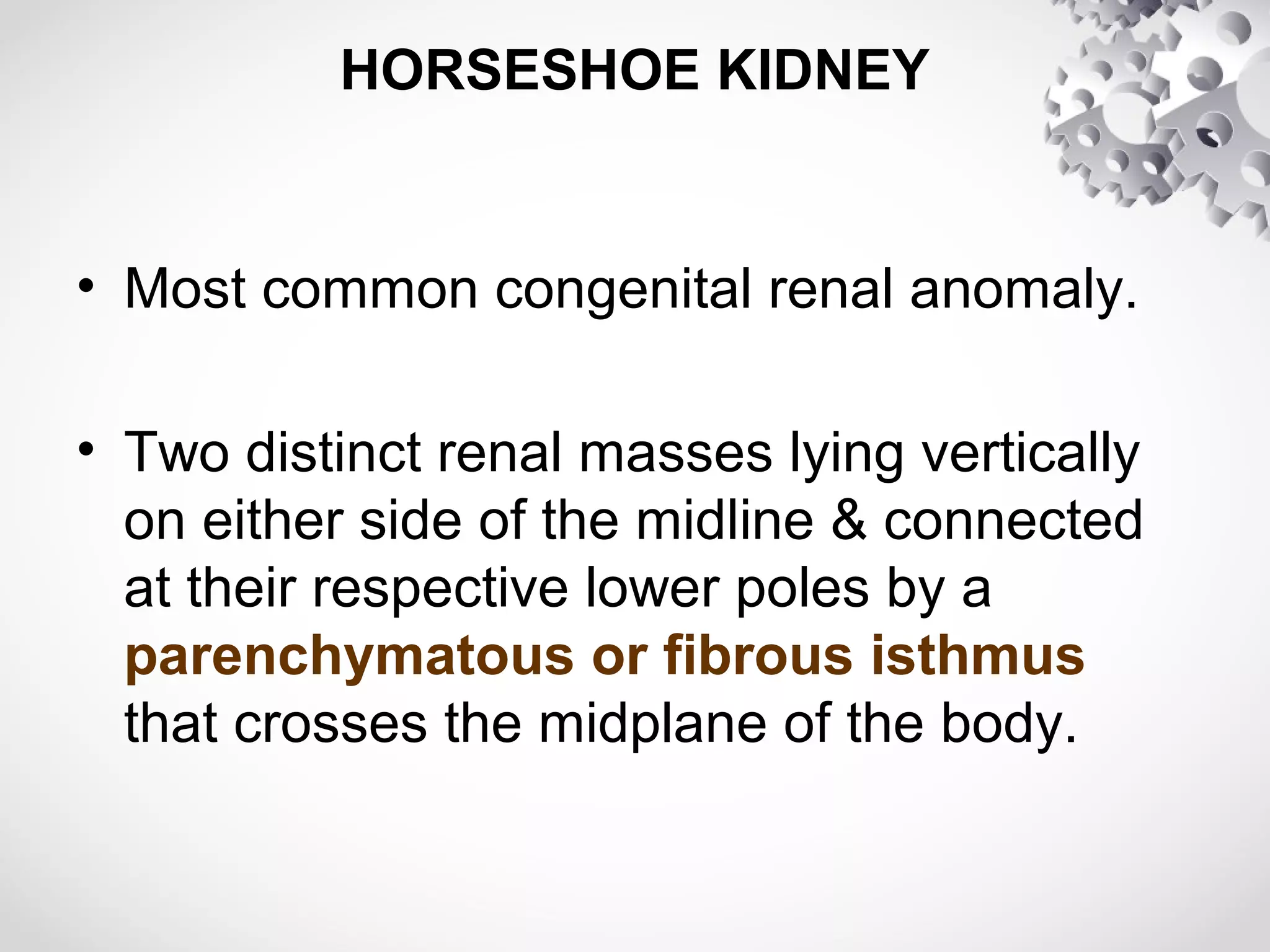 Horseshoe kidney & PCNL | PPT
