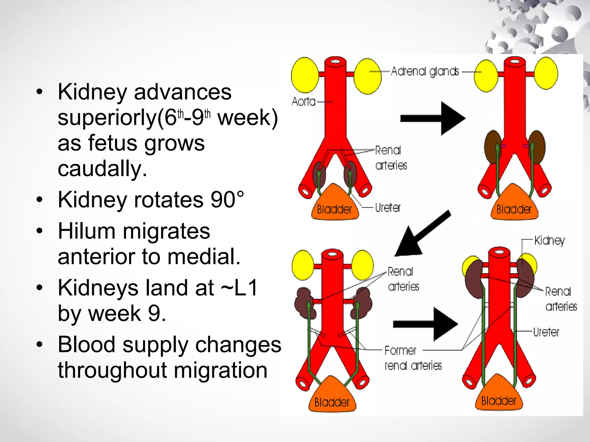 Horseshoe kidney & PCNL | PPT