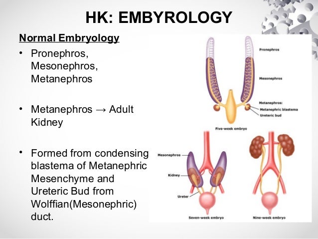 Horseshoe kidney & PCNL