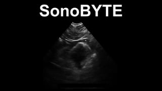 The ethics of incidental findings: James Rippey | PPT