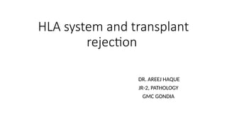 HLA system and TRANSplant rejection (2).pptx