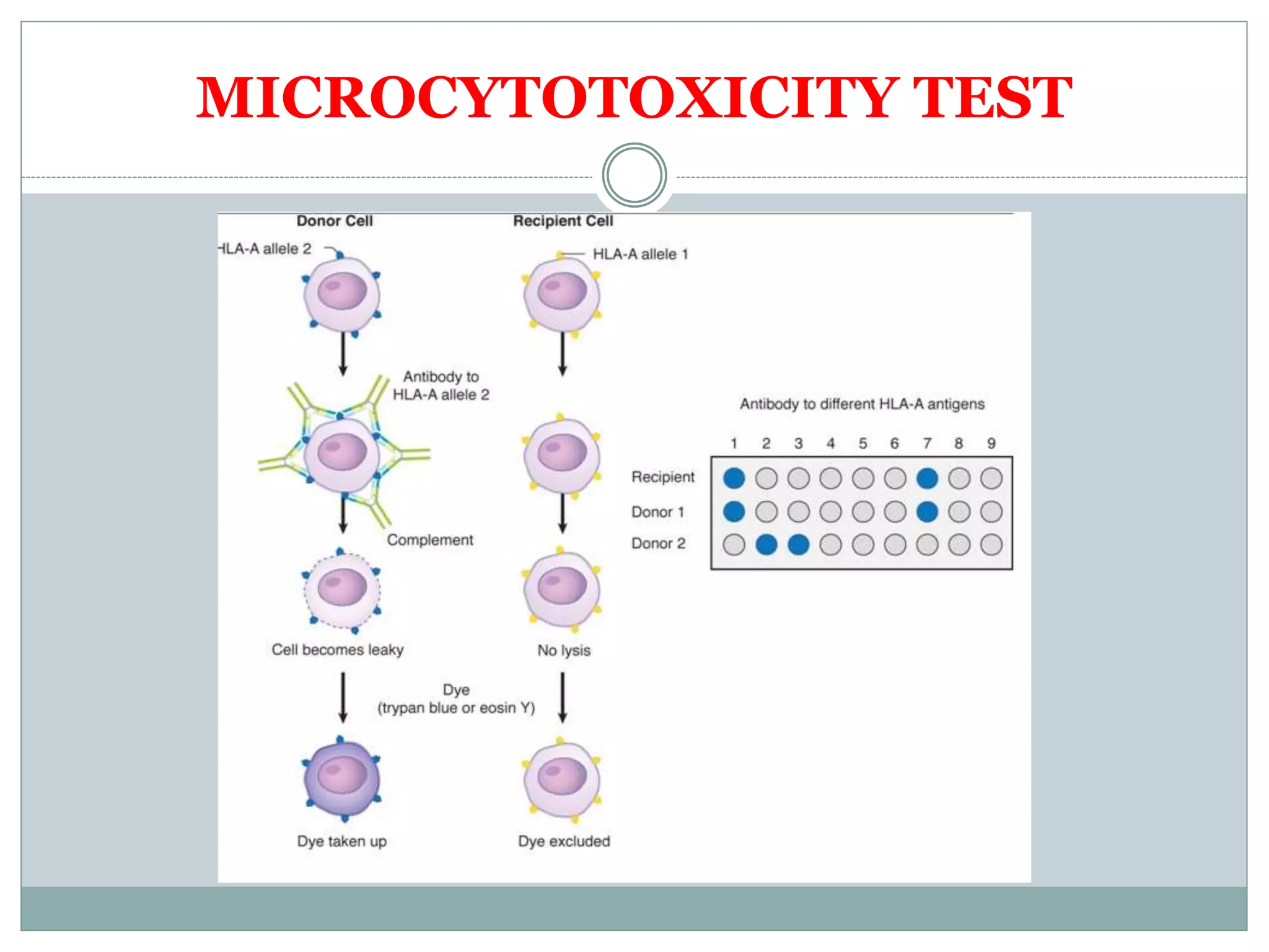 HLA tissue typing, HLA matching ,Microcytotoxicity test , Mixed ...