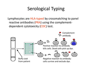 HLA typing.ppt