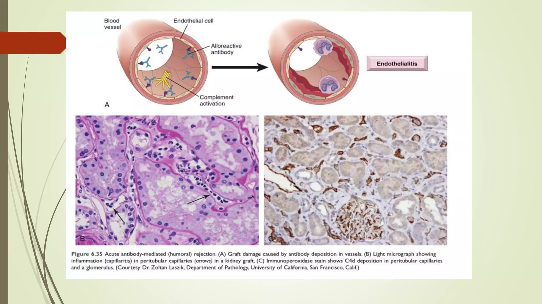 HLA Typing, Role in kidney transplant.pptx