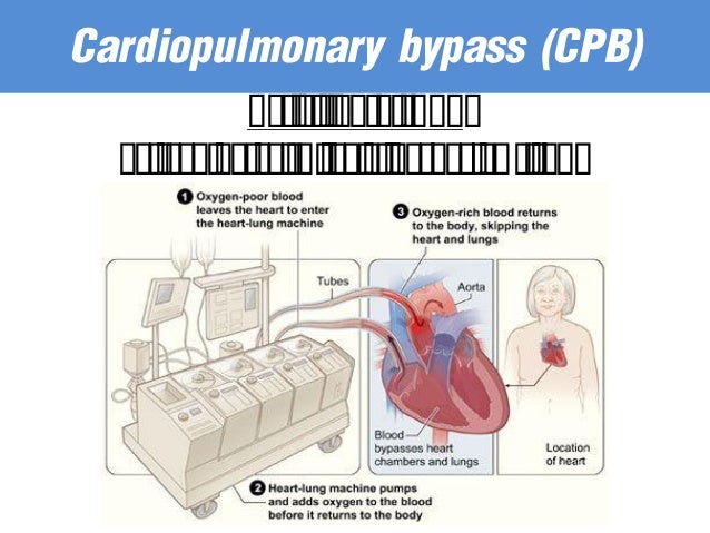 Basic Heart-Lung Machine in Cardiac Surgery