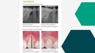 HOST MODULATION THERAPY | PPTX
