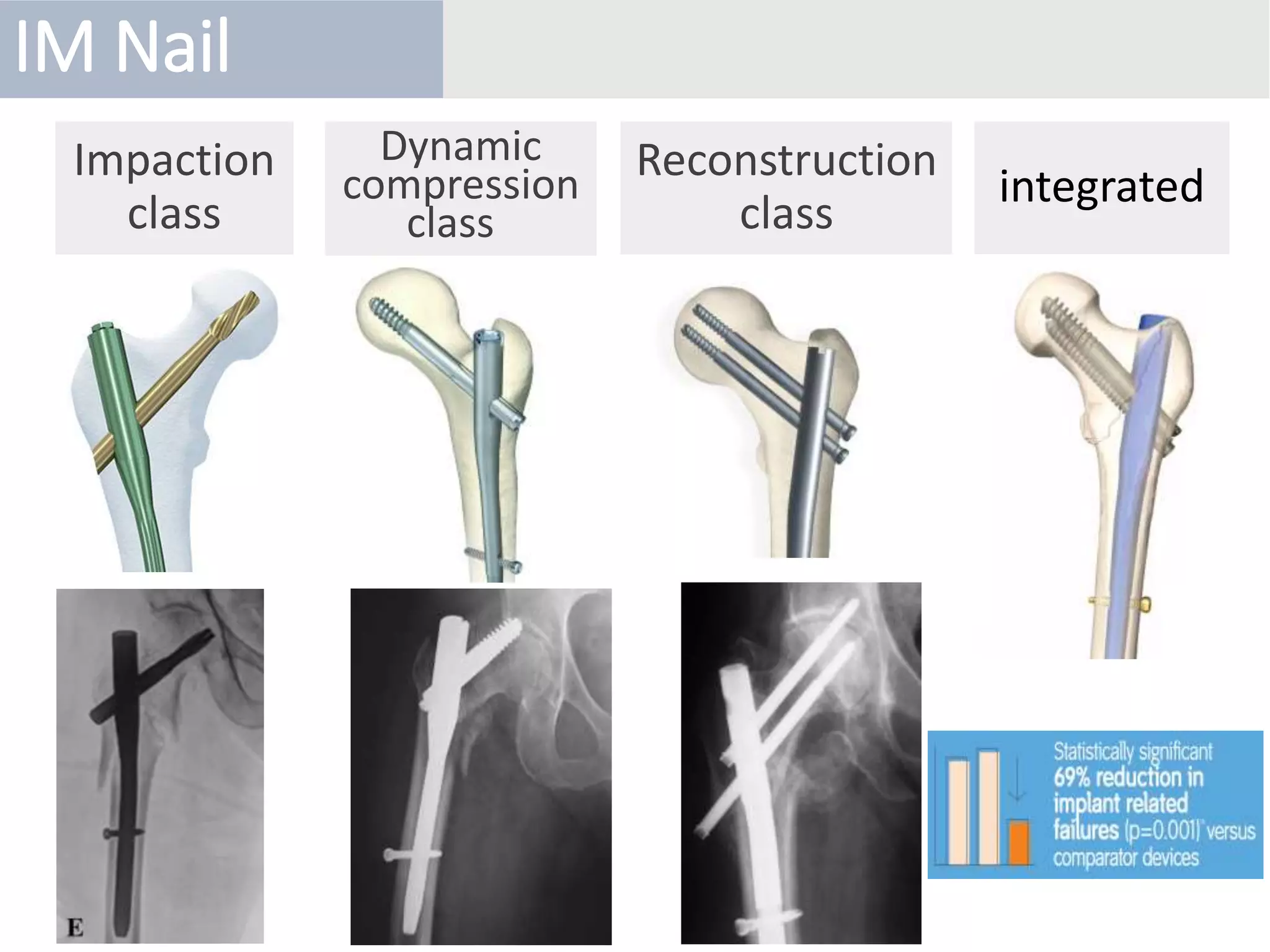 Intertrochanteric fracture surgical option | PPTX