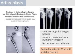 Intertrochanteric fracture surgical option | PPTX