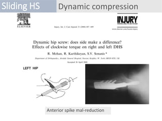 Intertrochanteric fracture surgical option | PPTX
