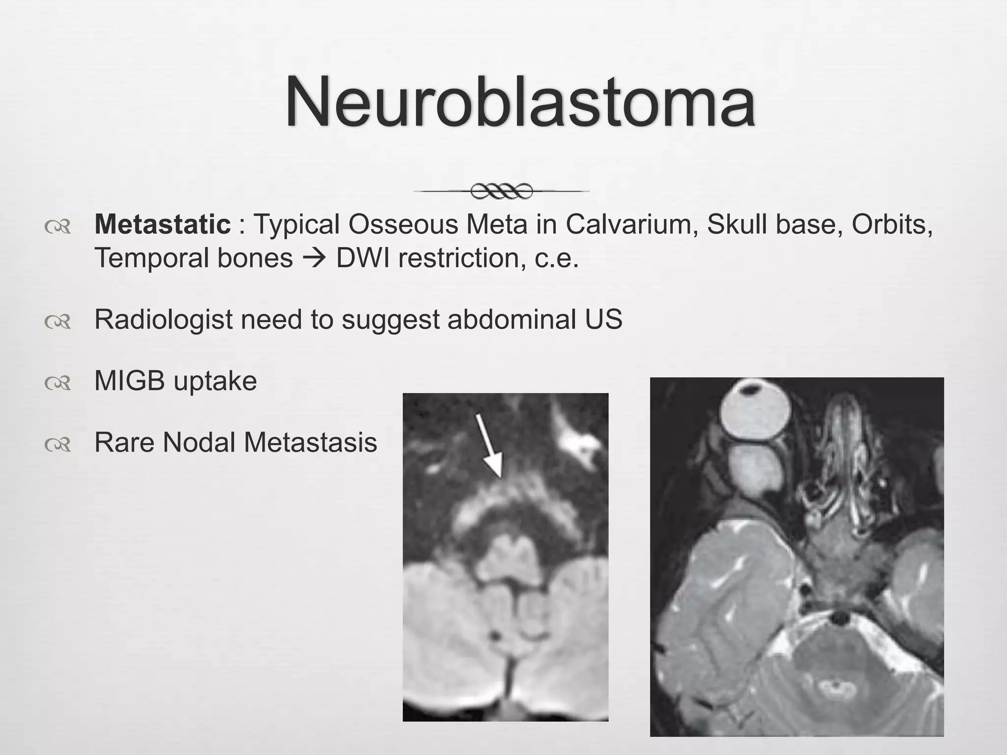 Head and Neck Masses In Children | PPTX