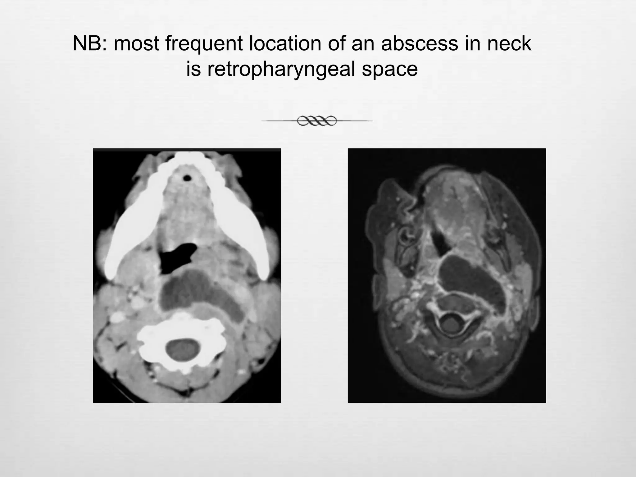 Head and Neck Masses In Children | PPTX