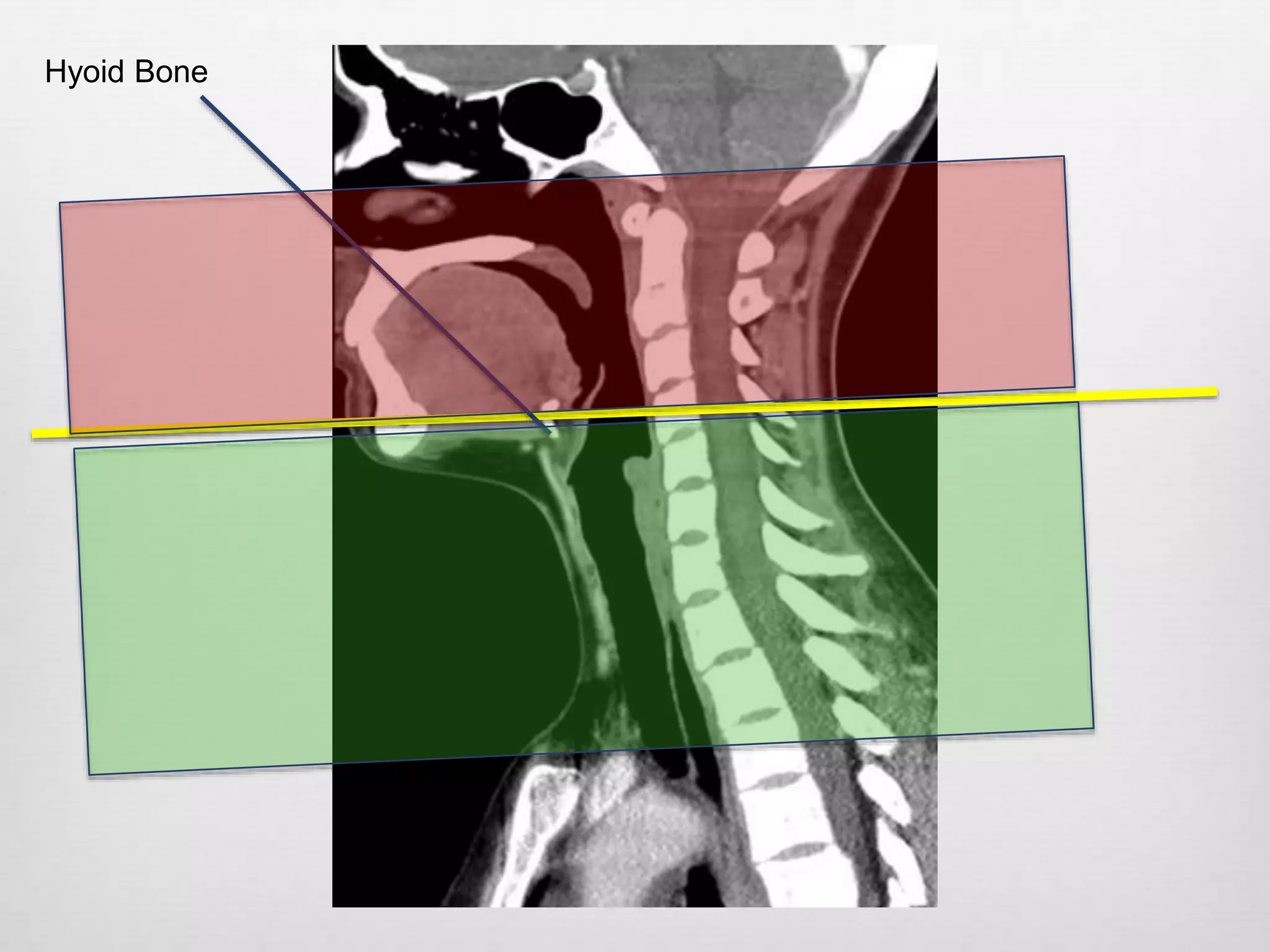 Head and Neck Masses In Children | PPTX