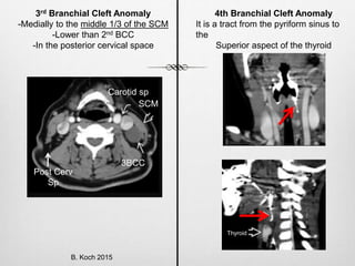 Head and Neck Masses In Children | PPTX