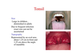 H&N- Soft Palate &Tonsils.pdf anatomy H&N | PDF