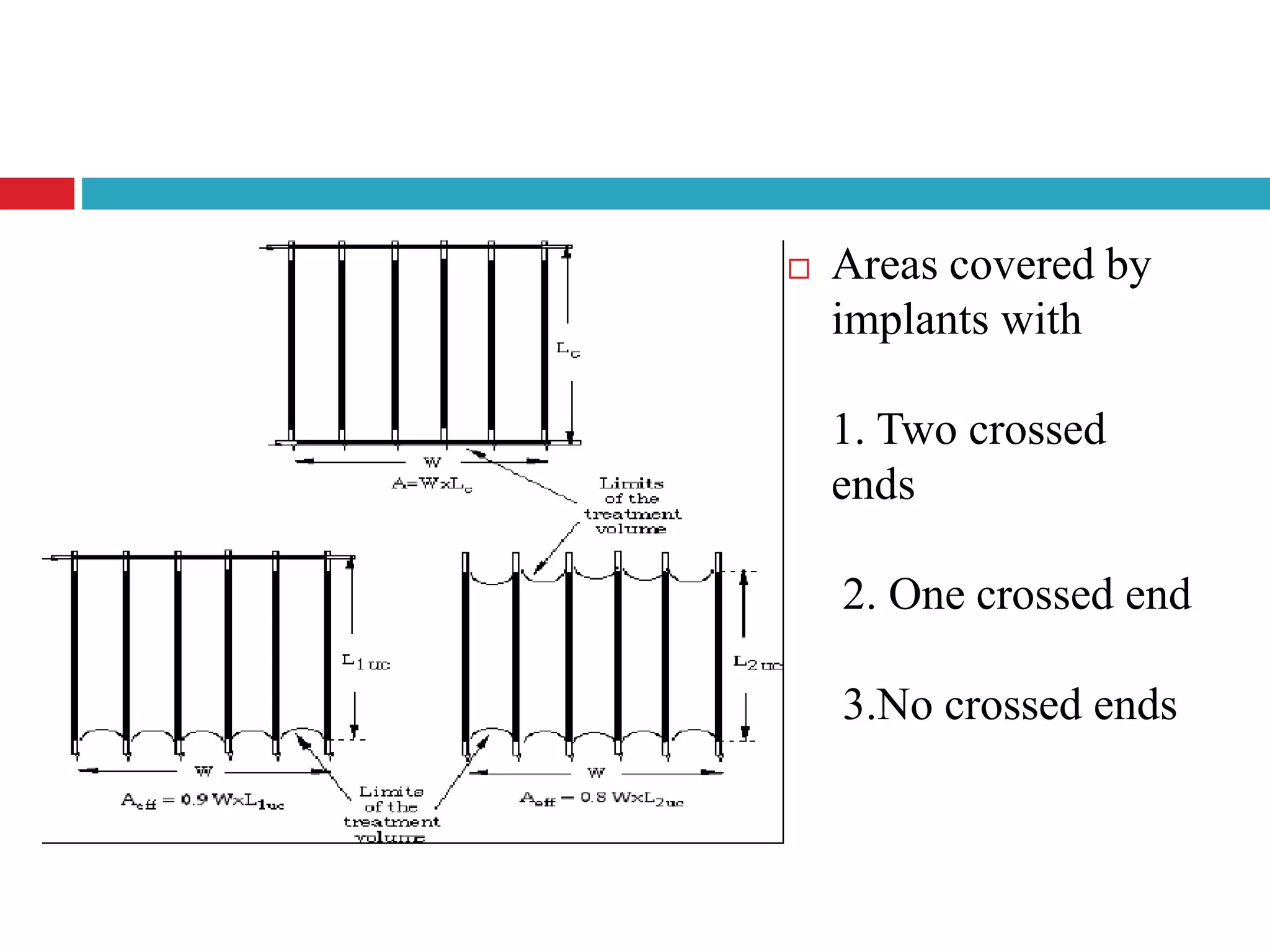 Head and neck; brachytherapy.pptx final | PPTX