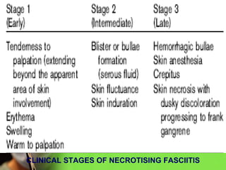 Necrotizing Fasciitis | PPT