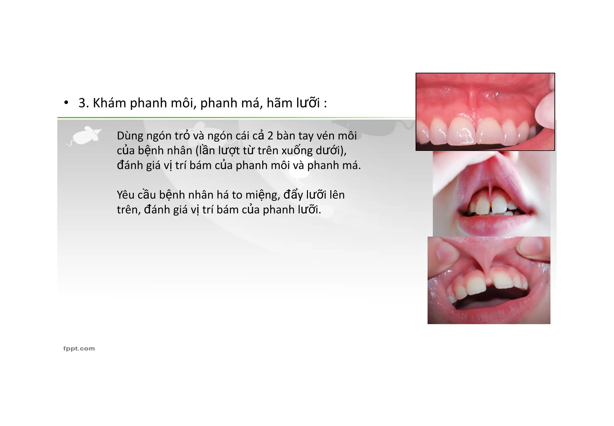 Hướng Dẫn Làm Bệnh Án Răng hàm mặt chi tiết | PDF