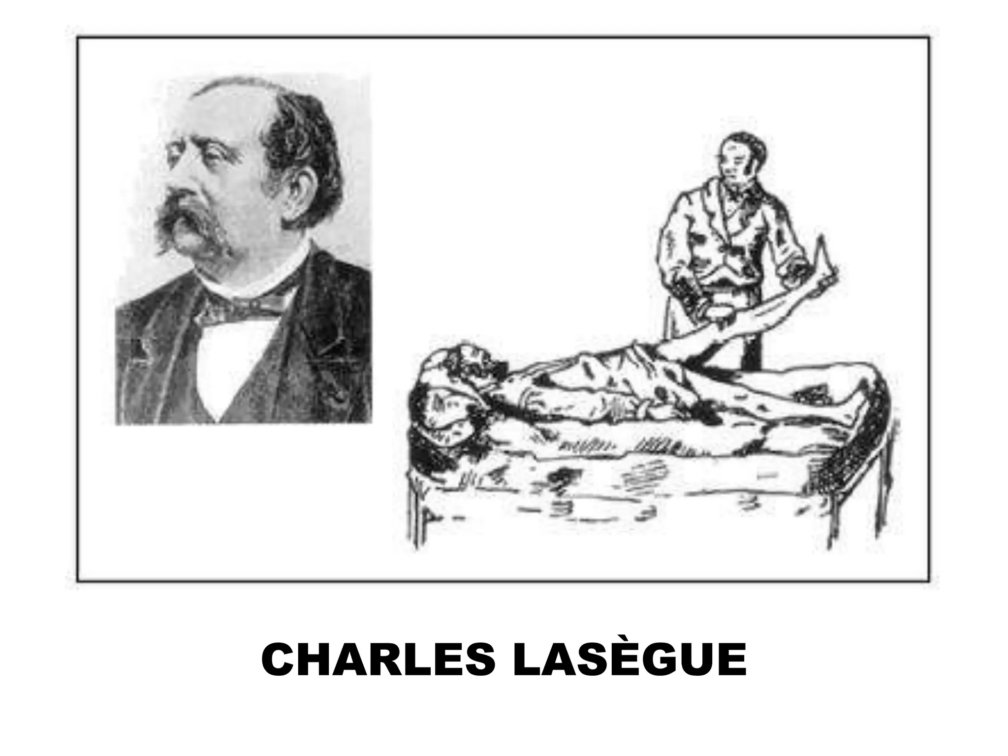 Herniated Nucleus Pulposus | PPTX