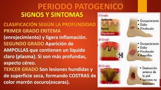 Hn quemaduras | PPTX
