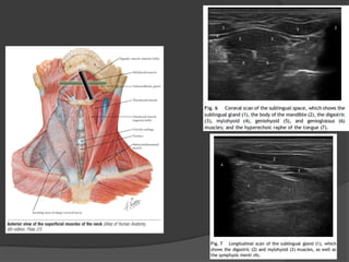 H&n sonographic anatomy of the neck and diffuse thyroid | PDF