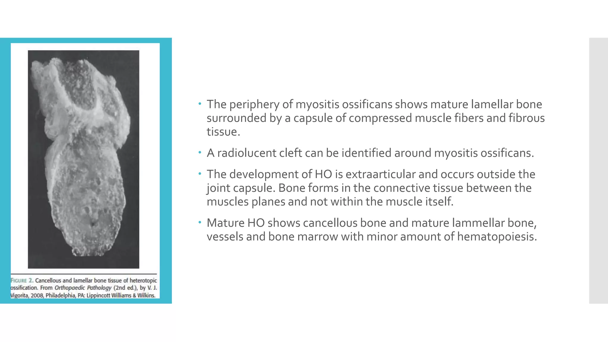 Heterotcopic classification For the role of bone scan | PPT