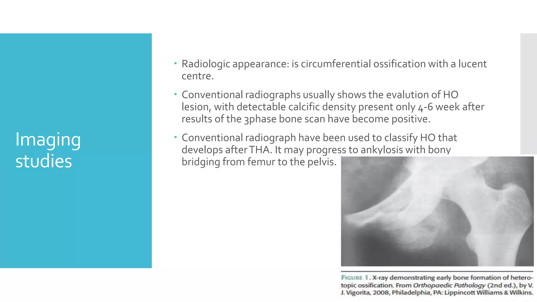 Heterotcopic classification For the role of bone scan | PPT