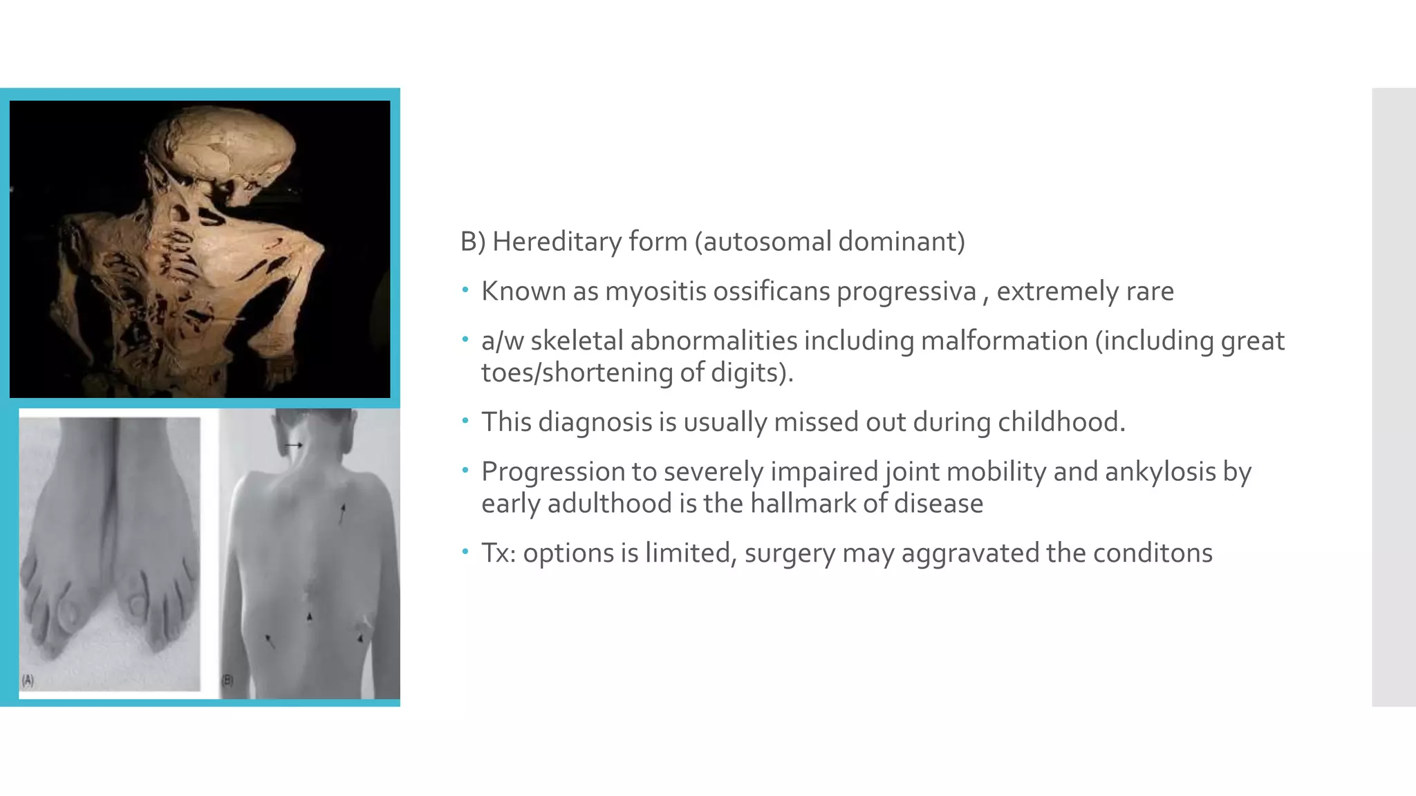 Heterotcopic classification For the role of bone scan | PPT