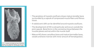 Heterotcopic classification For the role of bone scan | PPTX