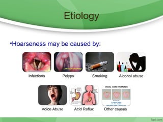 Hoarseness | PPT