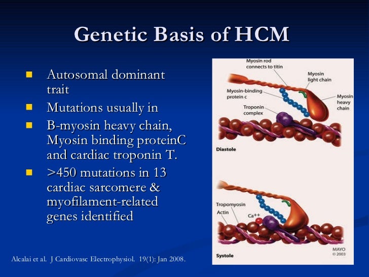 HYPERTROPHIC OBSTRUCTIVE CARDIOMYOPATHY (HOCM)