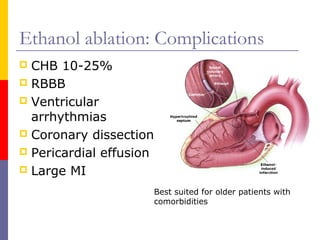 Hocm | PPT