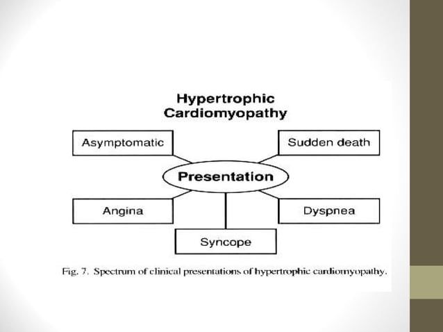 HOCM Hypertrophic cardiomyopathy | PPT | Heart and Cardiovascular ...