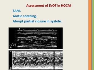 HOCM | PPT