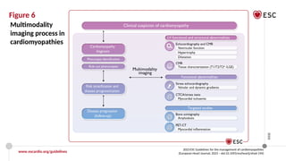 Comprehensive Overview of Hypertrophic Cardiomyopathy: Diagnosis ...