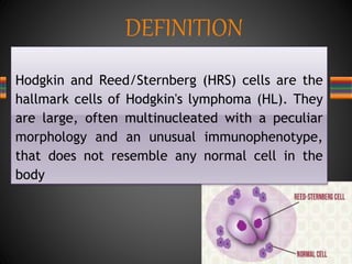 Hodgekin's ppt | PPT