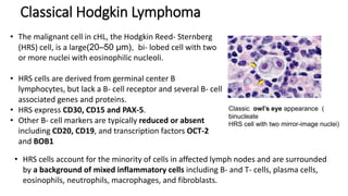 Hodgkin Lymphom.pptx