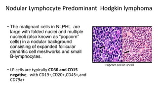 Hodgkin Lymphom.pptx