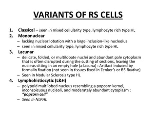 Hodgkin lymphoma | PPTX