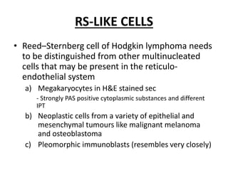 Hodgkin lymphoma | PPTX