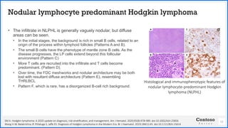 Hodgkin lymphoma presentaion and education | PPT