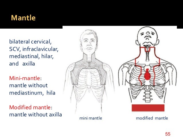 Hodgkin lymphoma db.pptx