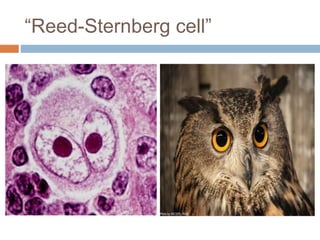 Hodgkin’s lymphoma | PPTX