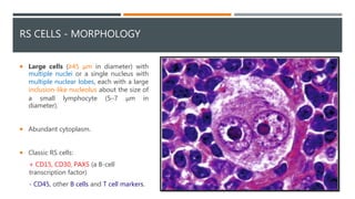 Hodgkin's lymphoma | PPTX