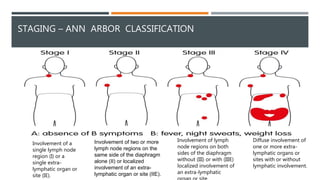 Hodgkin's lymphoma | PPTX