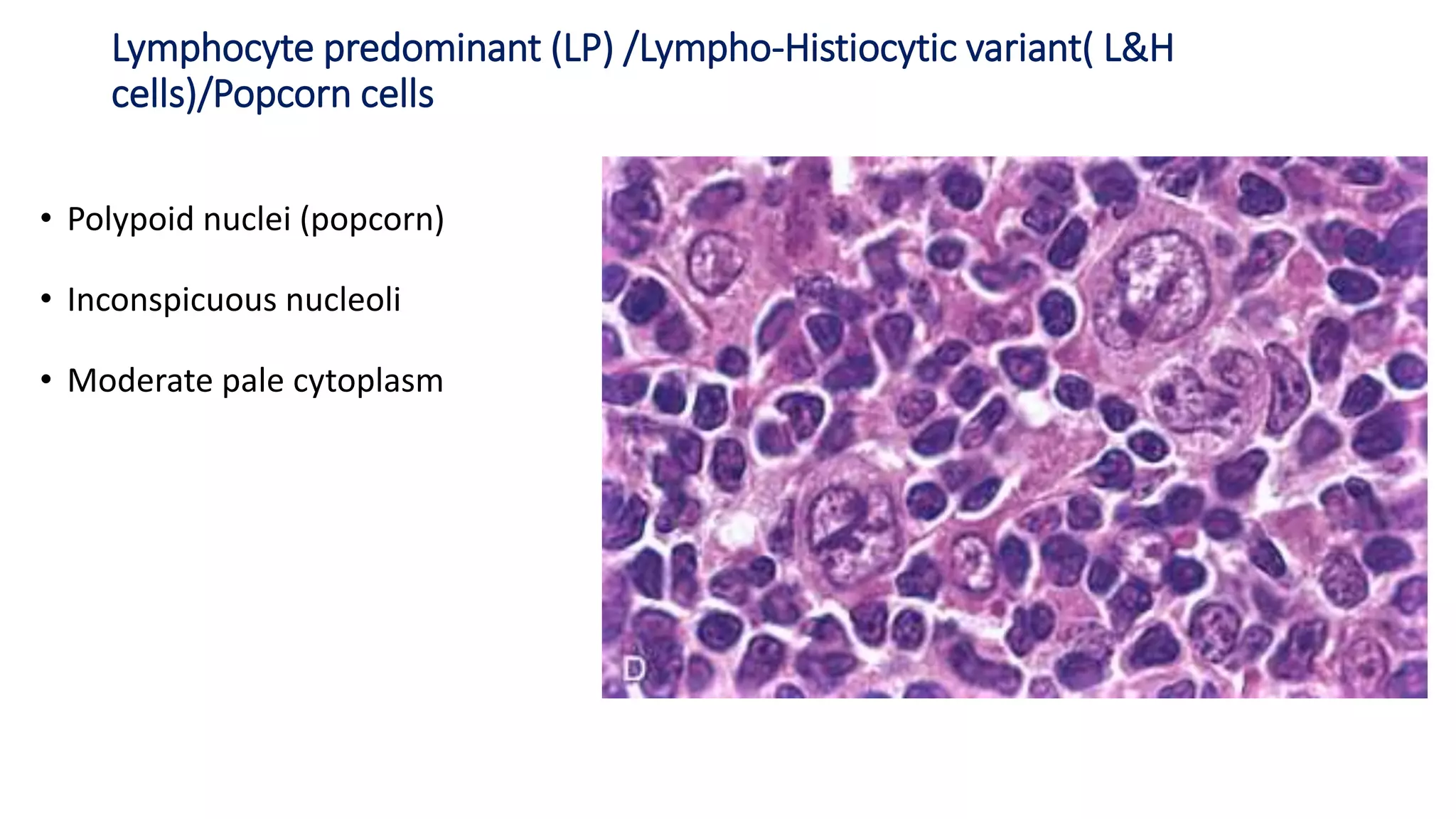 HODGKIN’S LYMPHOMA.pptx