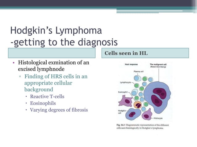 Hodgkins lymphoma pathogenesis and targets for therapy | PPT